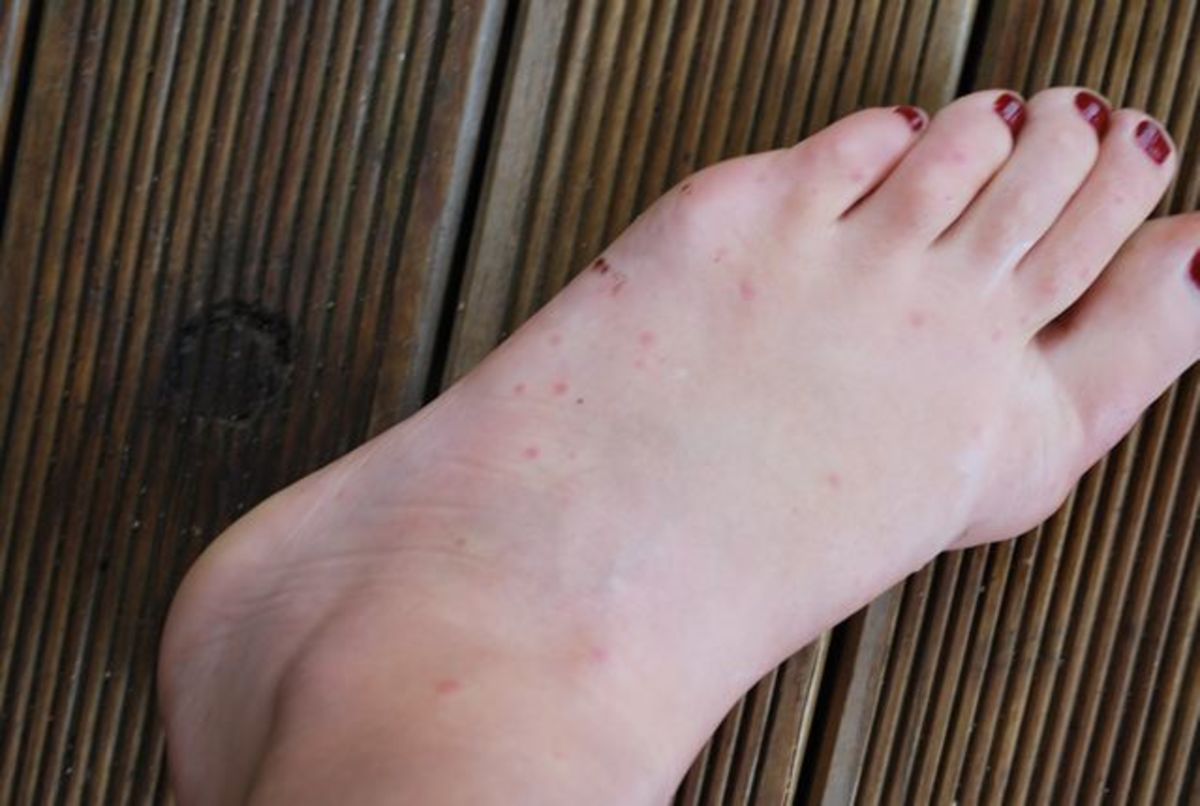 How to Avoid Bed Bugs When You Travel - WanderWisdom